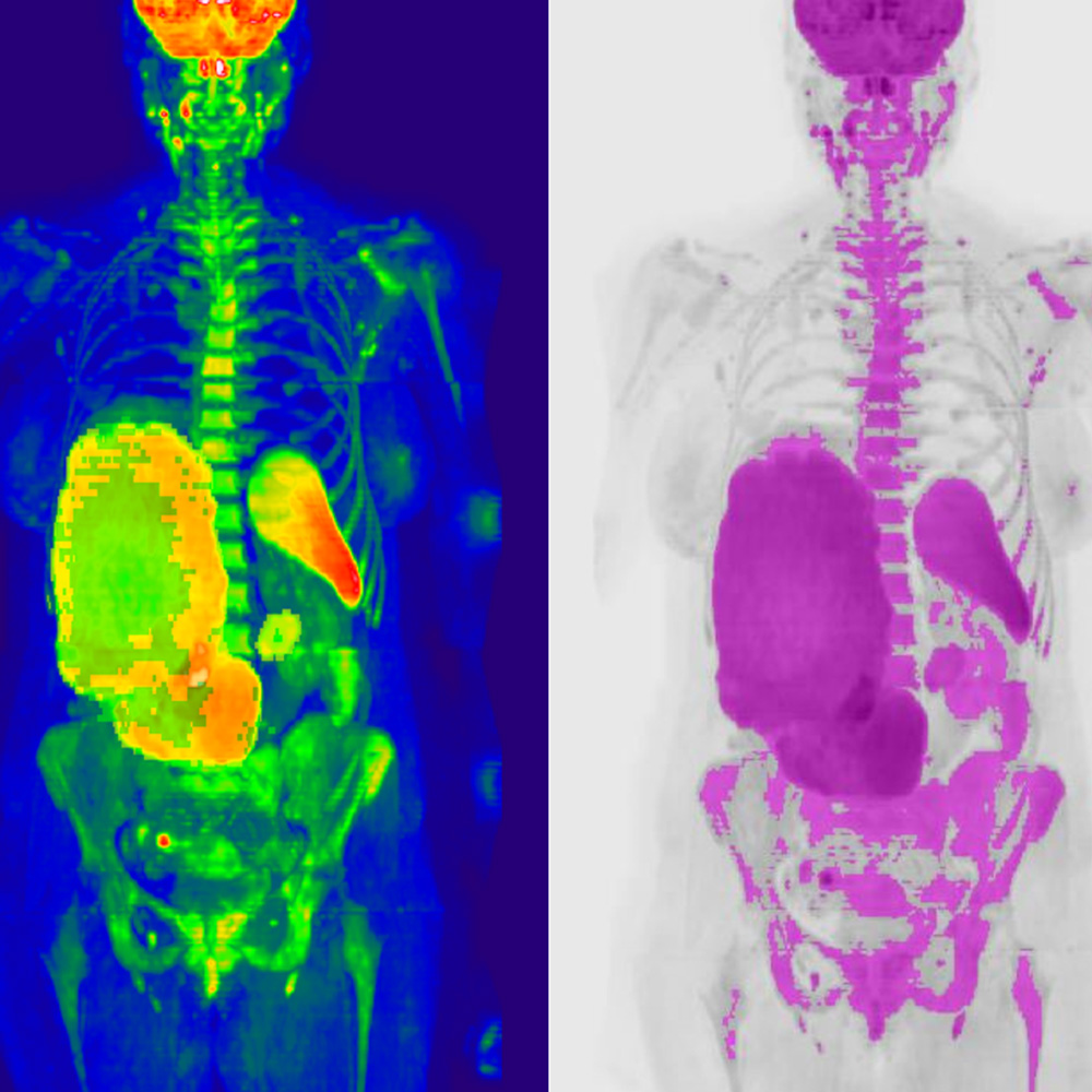 Masterclass In Oncological Whole Body Mri, 2Nd Edition - International ...